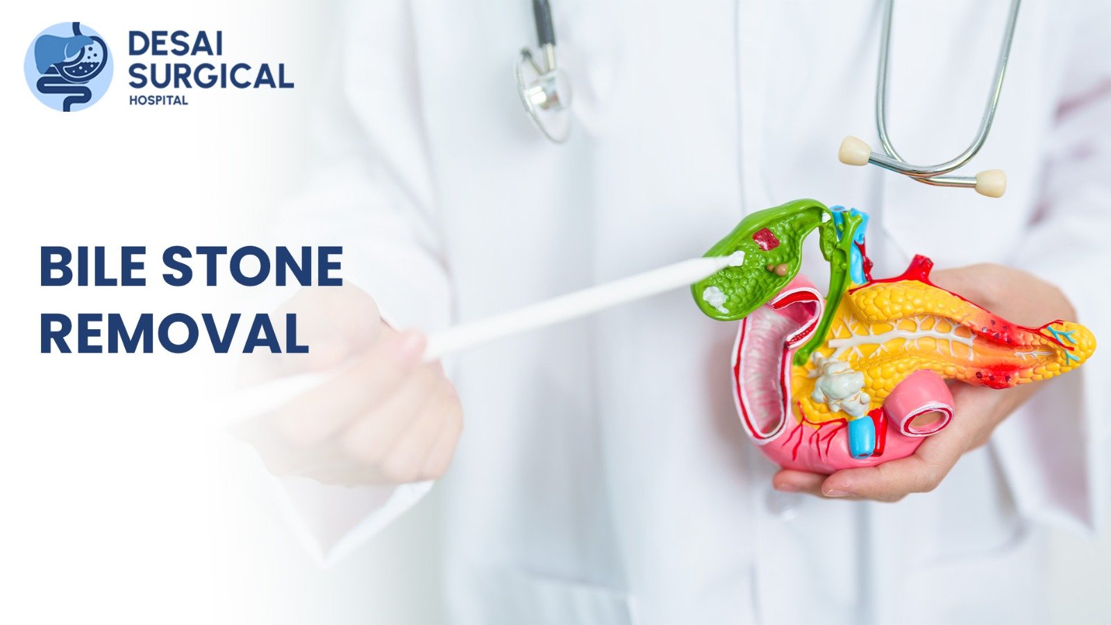 Bile Stone Removal - Desai Surgical Hospital
