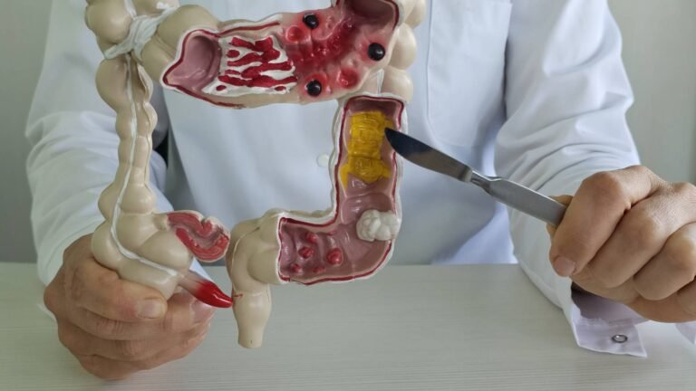 Colonic Polyps & Cancer: Symptoms, Causes & Treatment