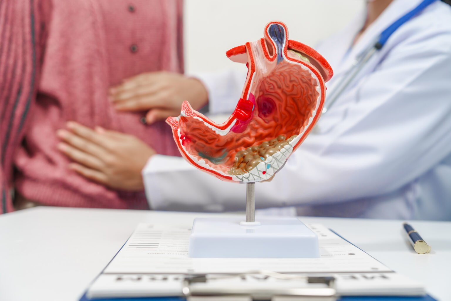 Myths and Facts About Gallbladder Removal Surgery