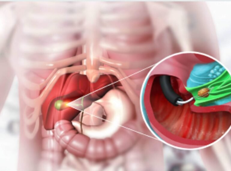 Best Gastrology Hospital in Vadodara – Desai Surgical Hospital